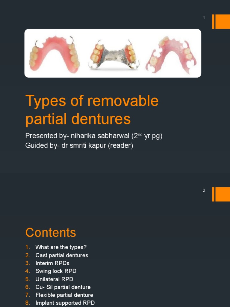 Types of Removable Partial Dentures | PDF | Dental Implant | Dentures