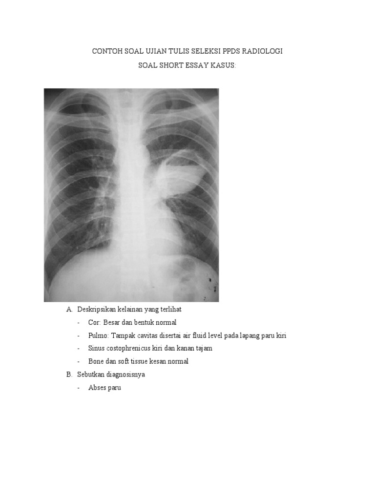 Contoh Soal Ujian Seleksi PPDS | PDF