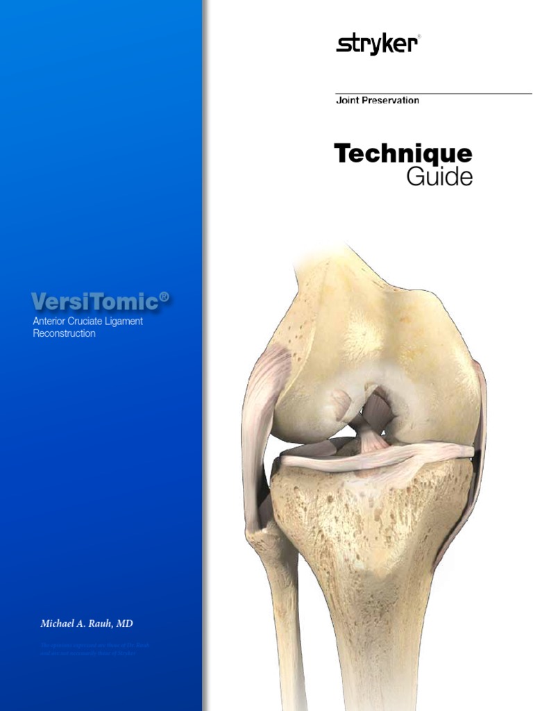 ACL Technique Guide | PDF | Knee | Orthopedic Surgery