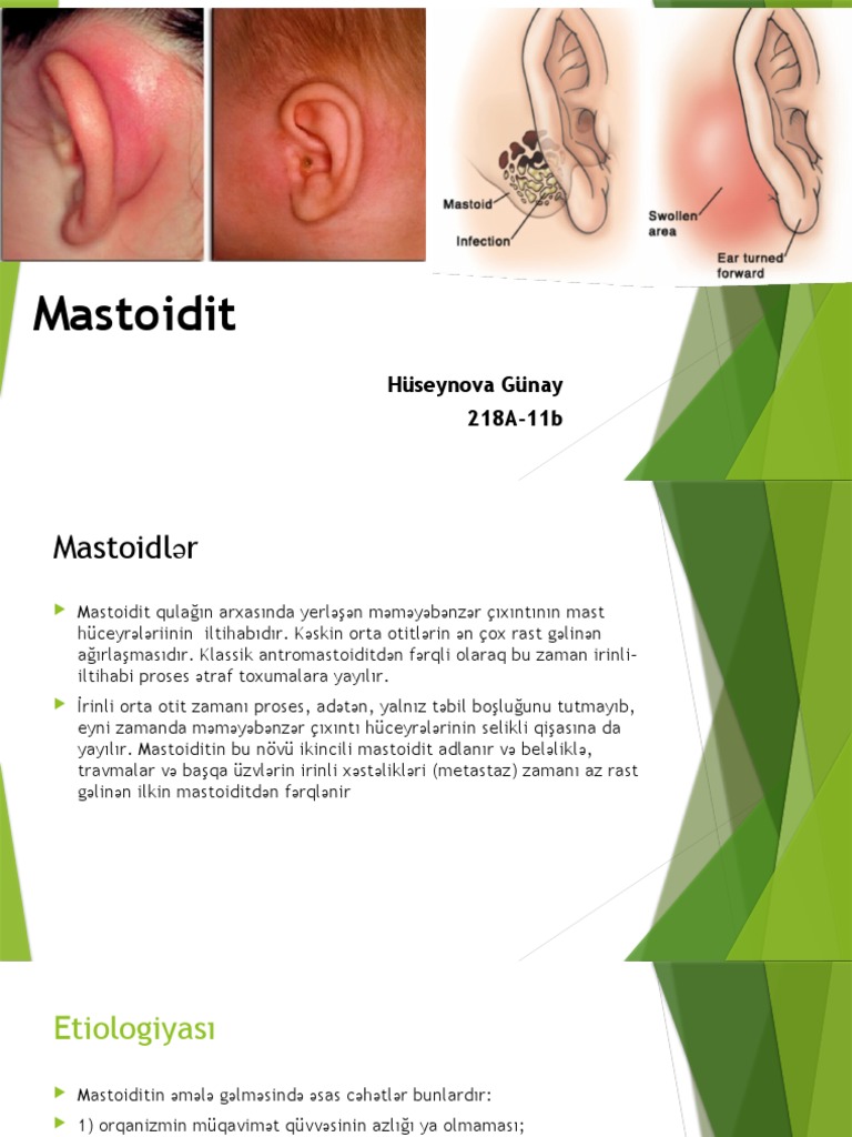 Mastoid It | PDF