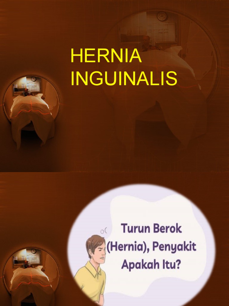 Hernia Inguinalis PPT 2023 | PDF