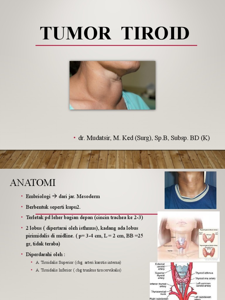 Kuliah Dr. Muda Tumor Tiroid | PDF