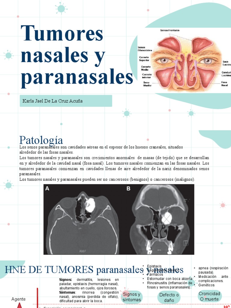 Tumores Historia Natural de La Enfermedad | PDF | Cáncer | Epidemiología