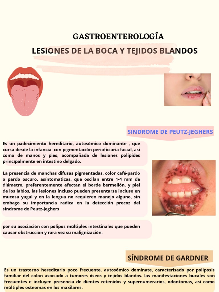 Lesiones de La Boca y Tejidos Blandos | PDF | Cáncer | Enfermedades y trastornos