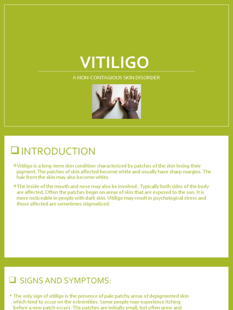 VITILIGO | PDF | Clinical Medicine | Skin