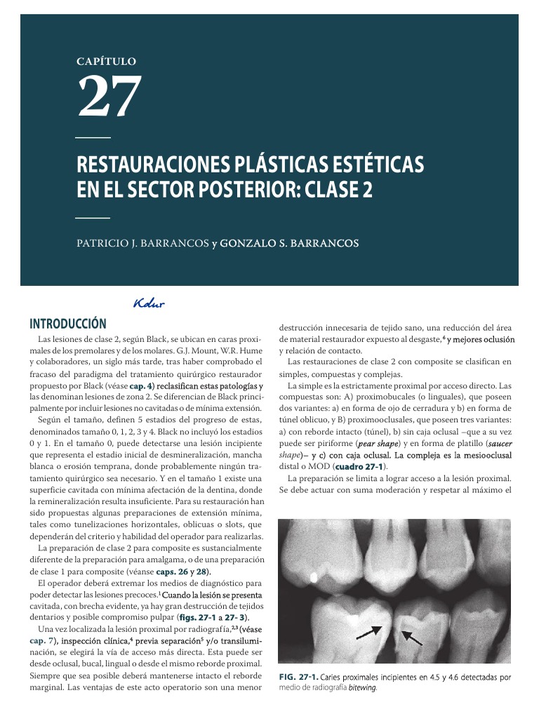 Posterior | PDF