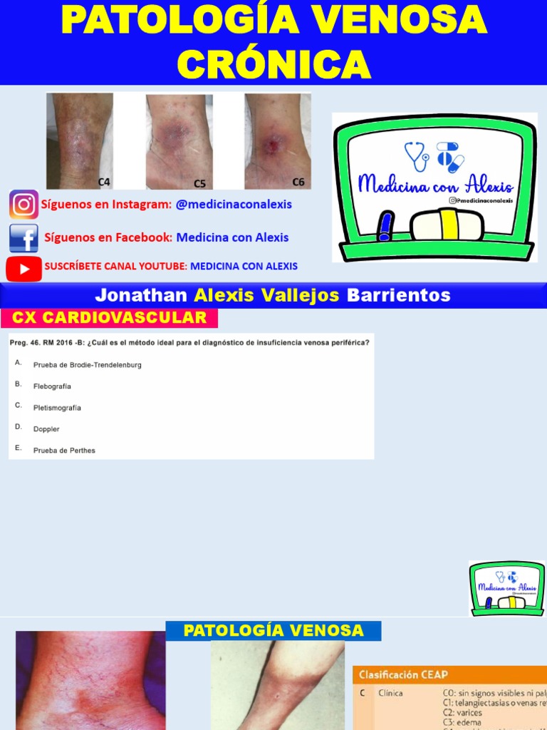 Jonathan Barrientos: Alexis Vallejos | PDF | Ultrasonido médico ...