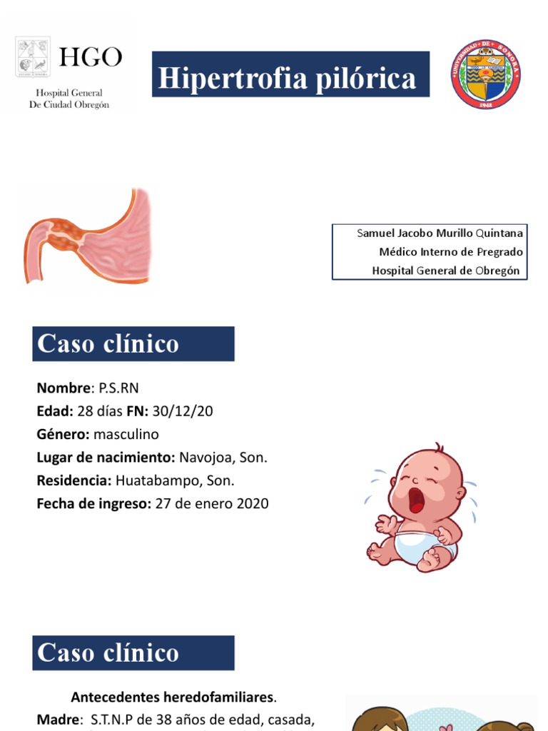Estenosis Hipertrófica de Píloro | PDF | Estómago | Especialidades Medicas