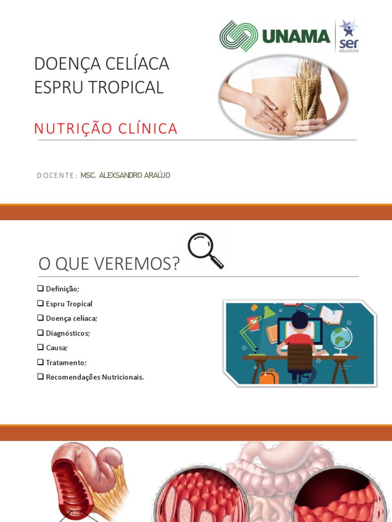 DOENÇA CELIACA & ESPRU TROPICAL (1) | PDF | Doença celíaca | Anemia