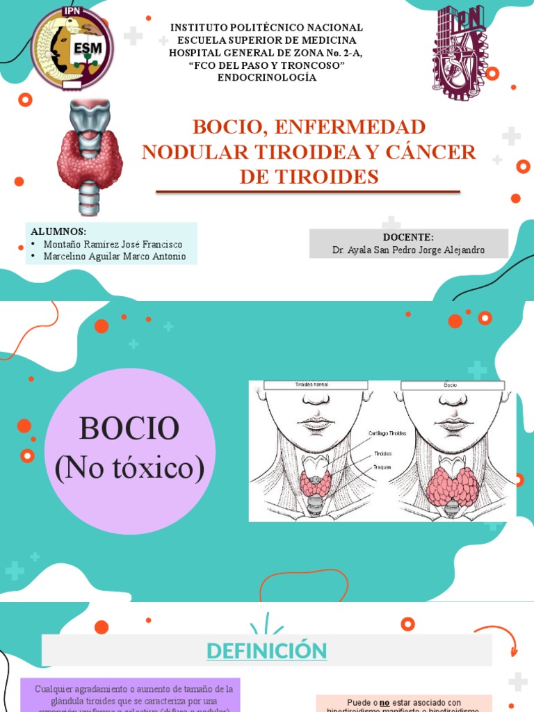 Bocio, Enfermedad Nodular Tiroidea y Cáncer de Tiroides | PDF ...