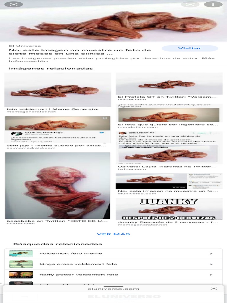 Voldemort Feto - Búsqueda de Google | PDF