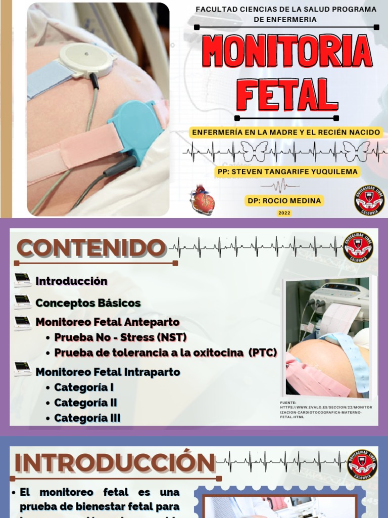 Categorías de Monitoreo Fetal ACOG | PDF | Parto | Especialidades Medicas
