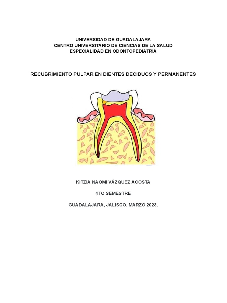 Recubrimiento Pulpar en Dientes Deciduos y Permanentes | PDF | Esmalte ...