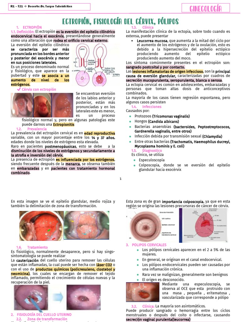 Ectropión Cervical: Definición y Tratamiento | PDF | Salud pública ...