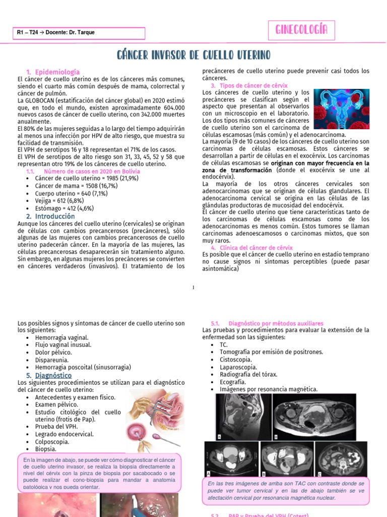 G-24 - Cáncer Invasor Del Cuello Uterino, Diagnóstico, Estadiaje y Tratamiento | PDF | Cáncer de ...