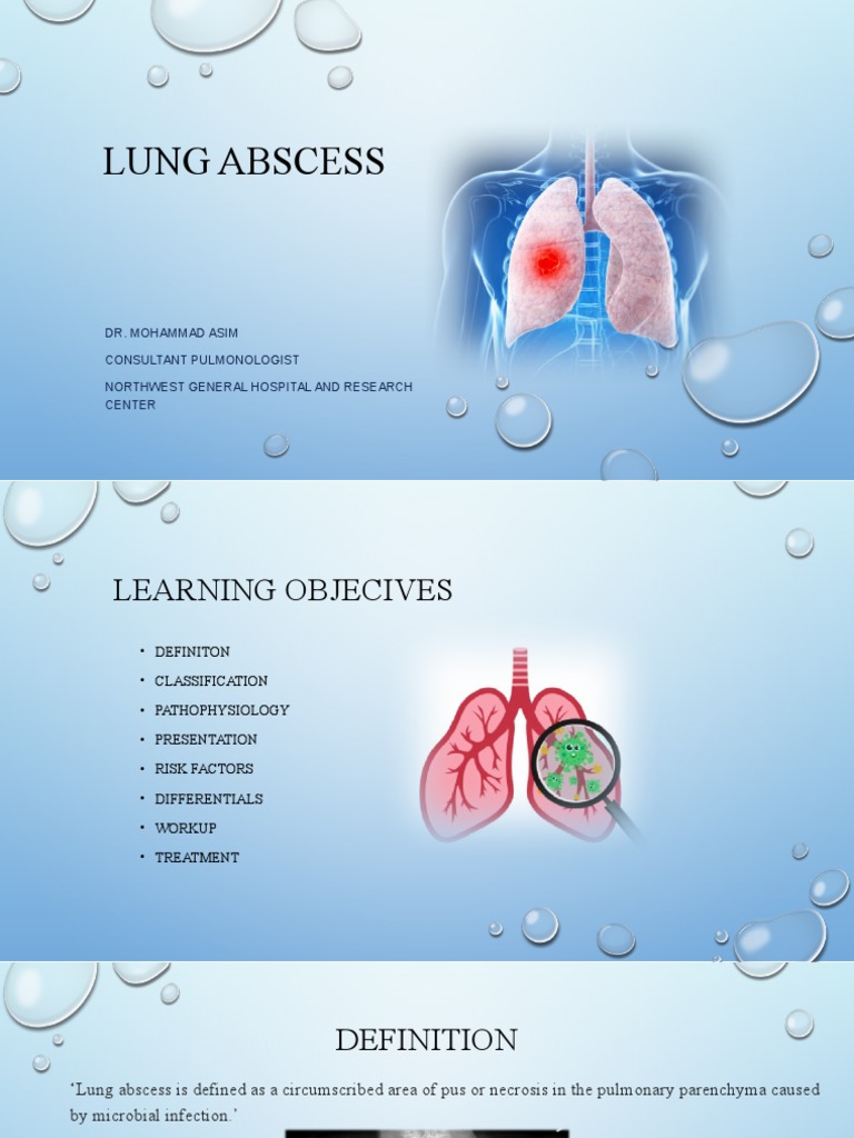 Lung Abscess | PDF | Pneumonia | Lung