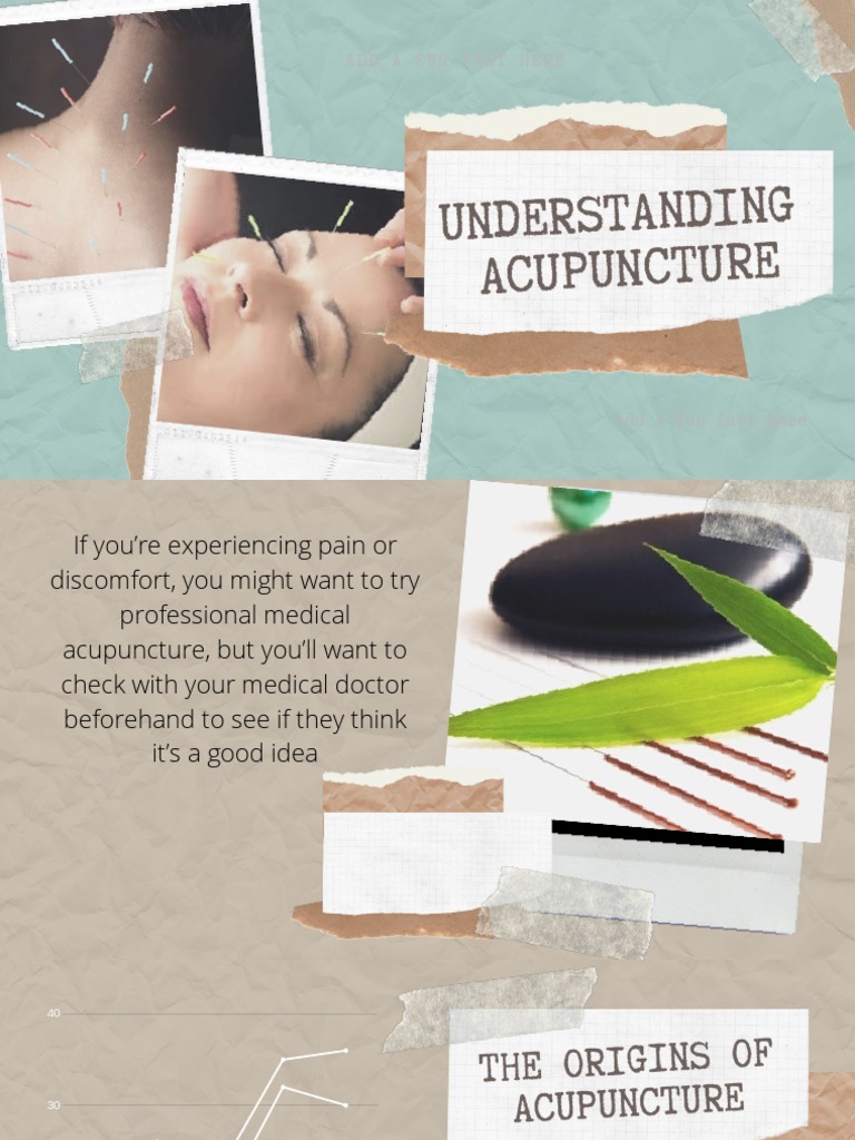 Understanding Acupuncture | PDF | Acupuncture | Pain
