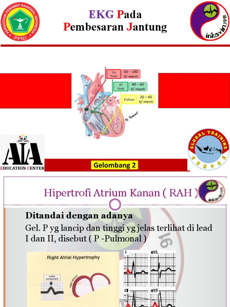 Hipertrofi 2018 | PDF