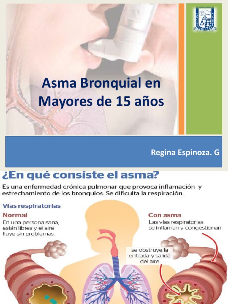 Asma Bronquial en Adultos: Diagnóstico y Tratamiento | PDF | Asma | Tos