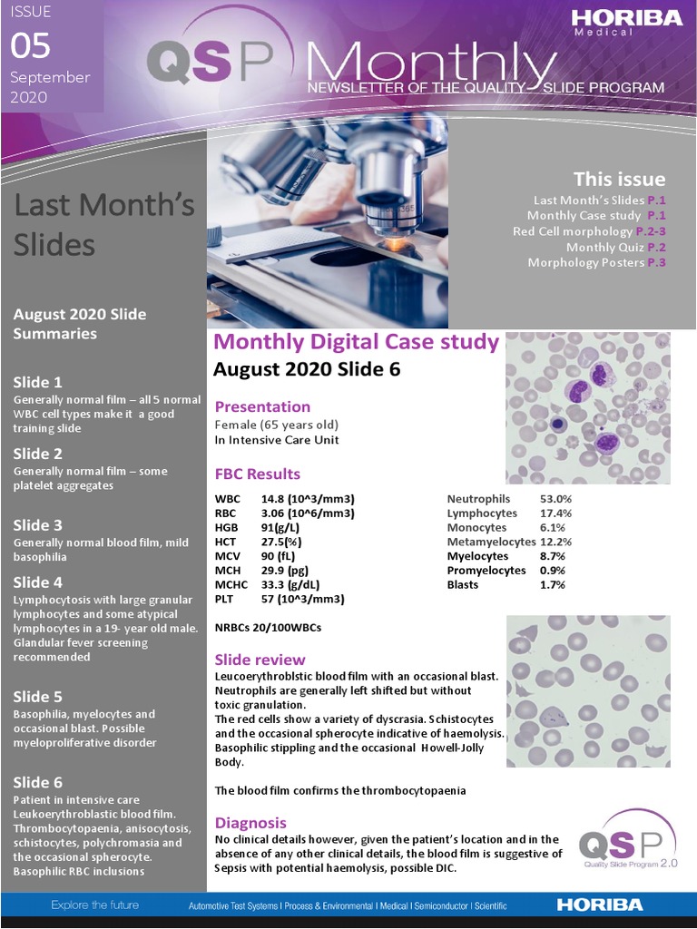 Case 5 (RBCs Inclusions) | PDF | Red Blood Cell | White Blood Cell