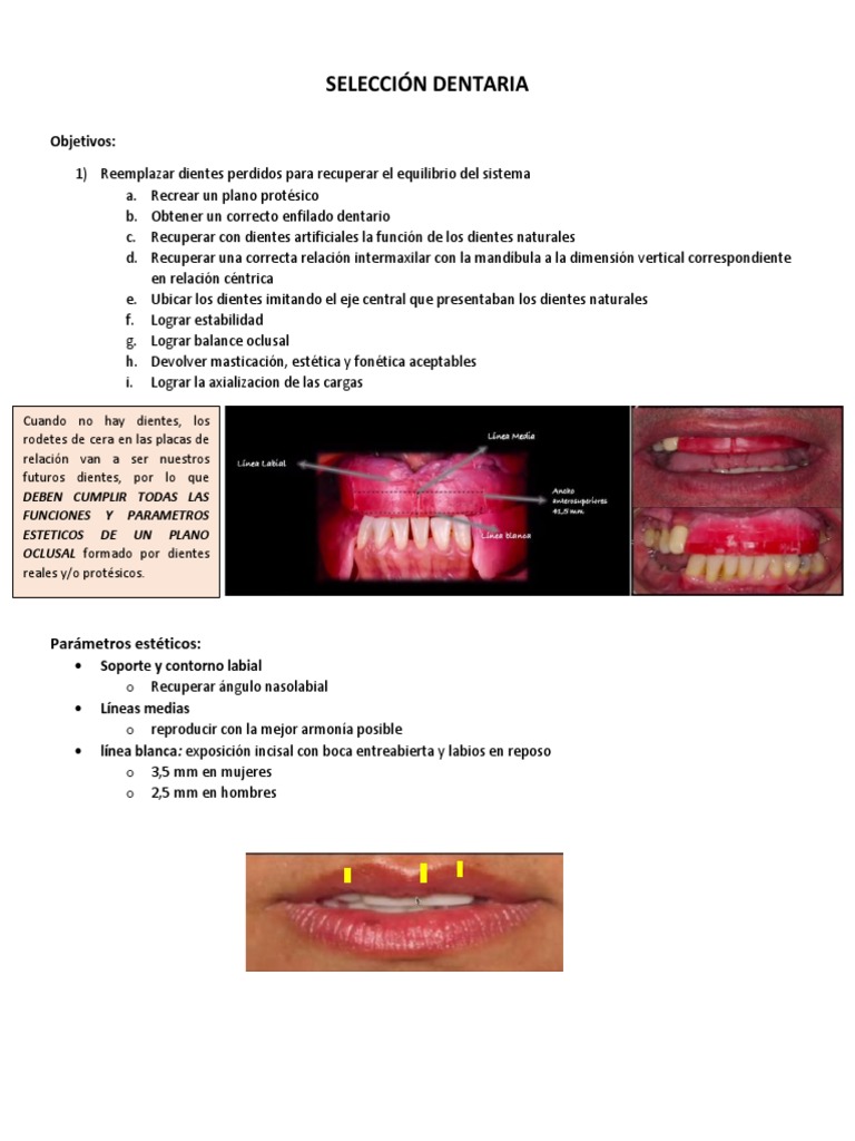 Clase 27 Seleccion de Dientes Artificiales en Protesis Totales | PDF ...