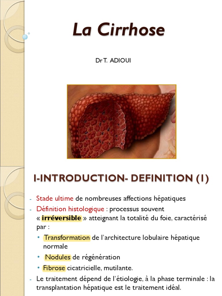 Cirrhose Dr ADIOUI | PDF | Cirrhose | Gastroentérologie