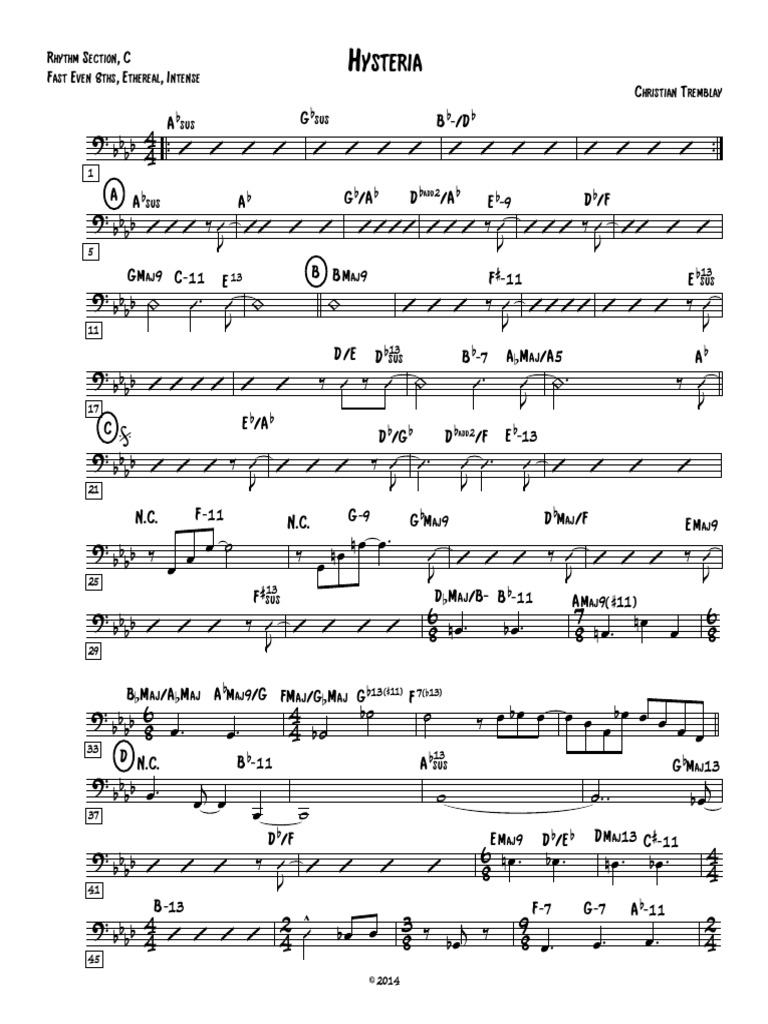 Hysteria RS PART | PDF