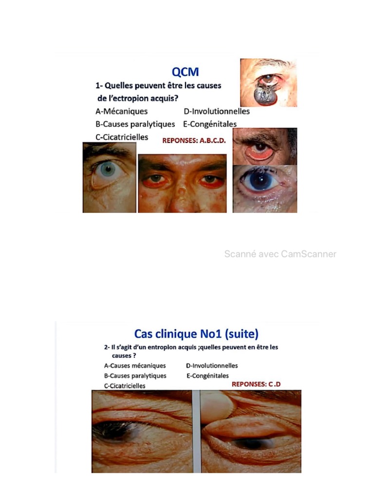 QCM Ophtalmo | PDF