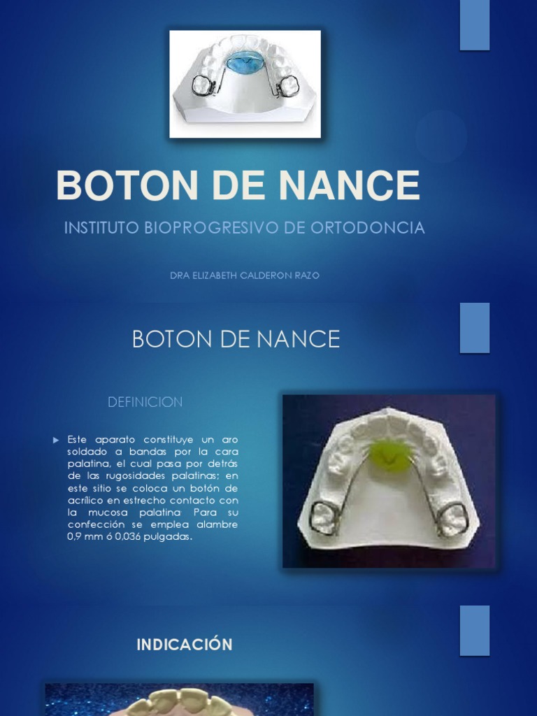 Boton de Nance | PDF