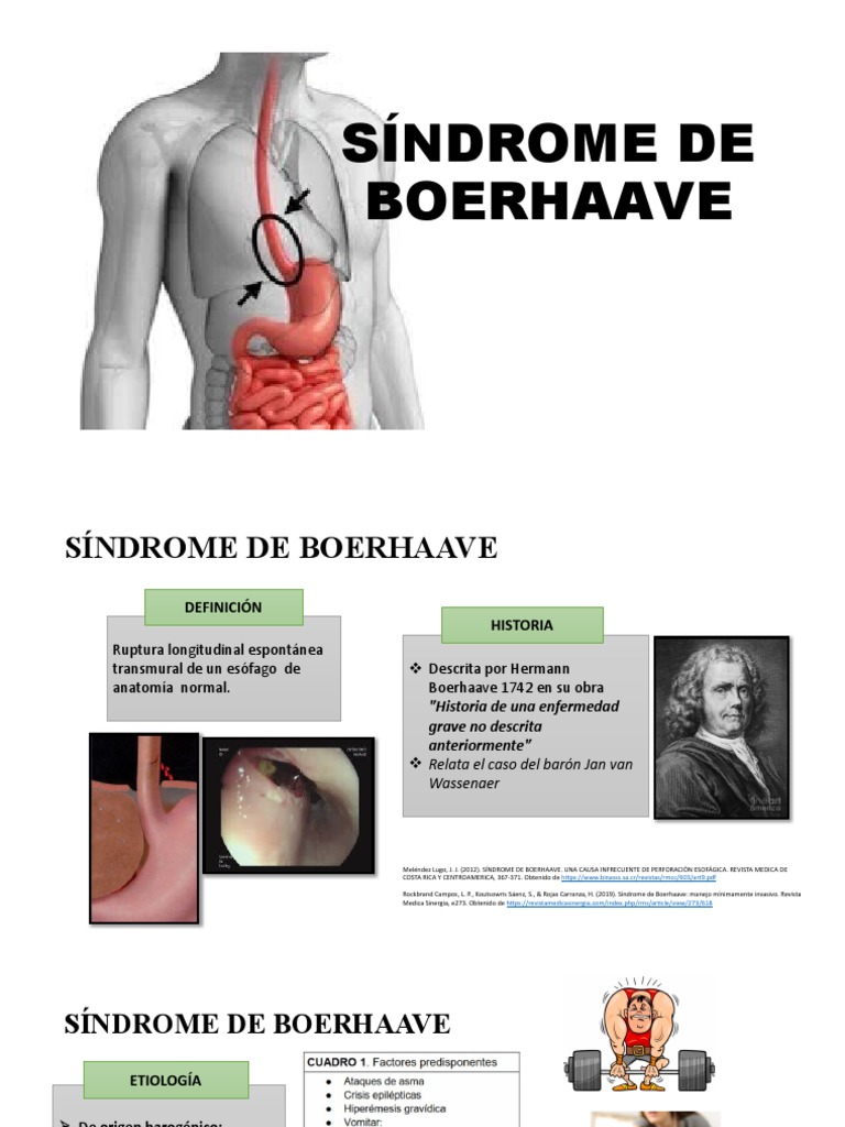 Syndrome De Boerhaave Physiopathologie – IDSQ