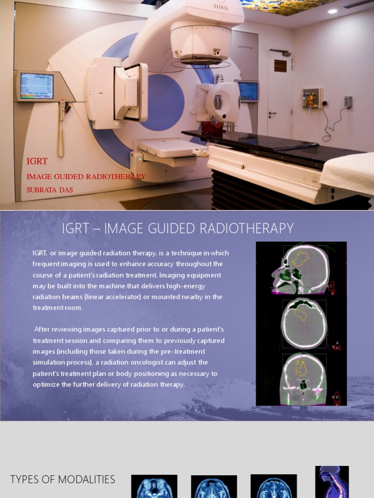 Image Guided Radiotherapy technique - IGRT | PDF | Radiation Therapy ...