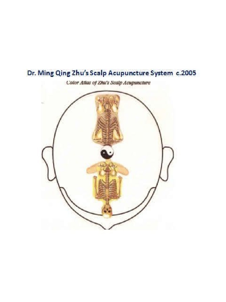 Zhu Scalp Acupuncture Chart Pdf