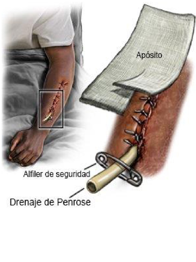 Penrose 2 | PDF