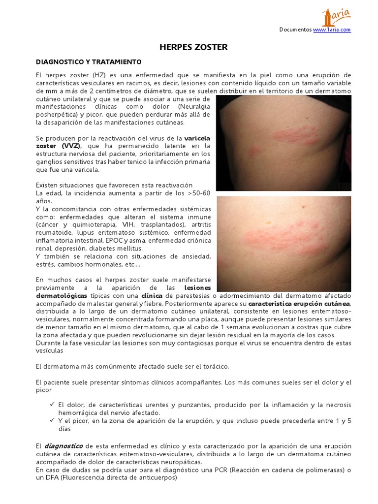 Herpes Zoster 2022 Tratamiento | PDF | Inmunología | Ciencias de la Salud