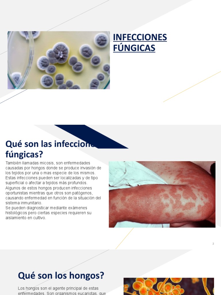 Infecciones Fúngicas: Tipos y Causas | PDF | Candidiasis | Hongo
