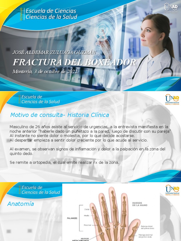 Caso Clinico - JoseZuluaga FX Del Boxeador | PDF | Mano | Medicina CLINICA