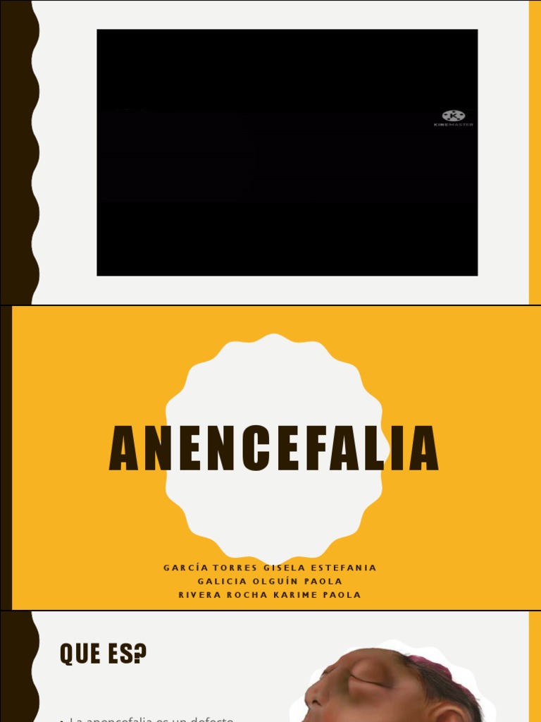 Anencefalia y Microcefalia: Causas y Diagnóstico | PDF | El embarazo ...