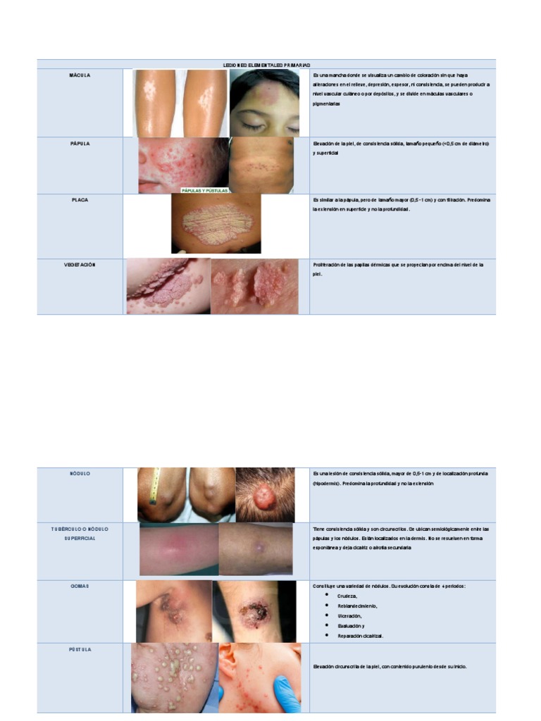 Lesiones de La Piel | PDF | Piel | Anatomía
