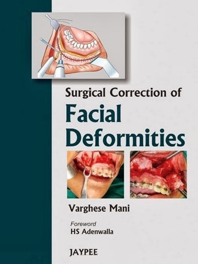 Surgical Correction of Facial Deformities | PDF