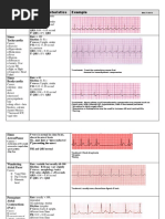 Basic EKG ECG Rhythms Cheatsheet | PDF | Electrocardiography | Cardiac ...