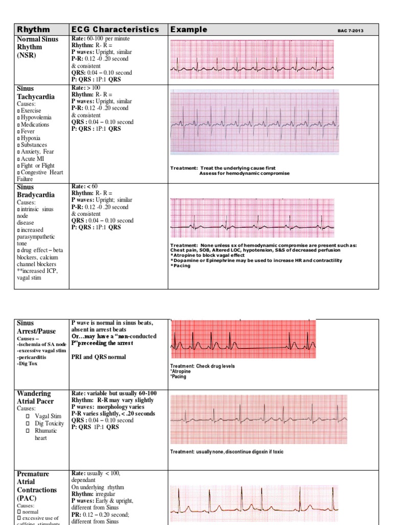 EKG Rhythms | PDF | Artificial Cardiac Pacemaker | Cardiopulmonary ...