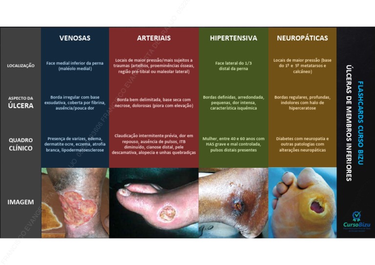 Tipos de Úlceras em Membros Inferiores | PDF | Angiologia | Doenças e ...