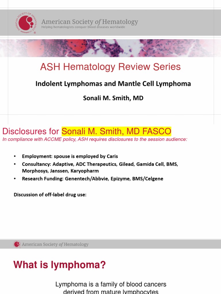 ASH Hematology Review Series - Indolent Lymphomas | PDF | Lymphoma | Cancer
