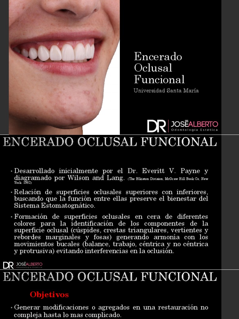 Encerado Funcional | PDF