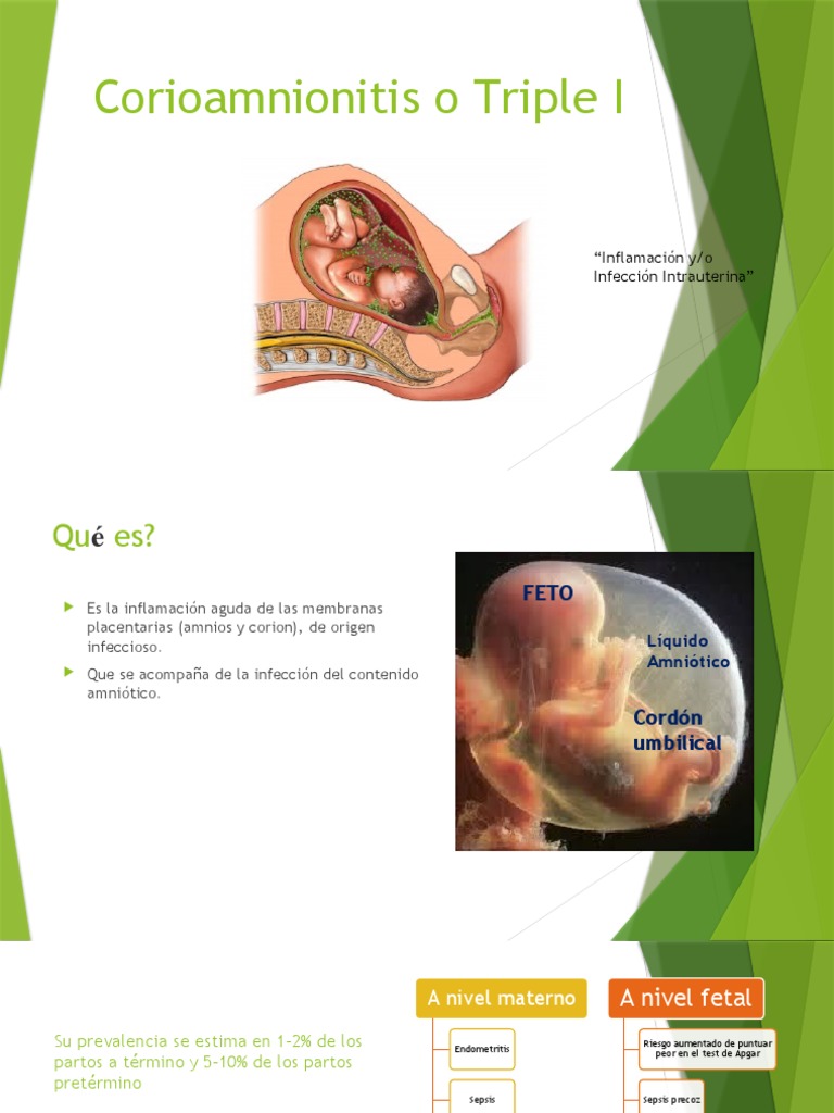 Corioamnionitis o Triple I | PDF