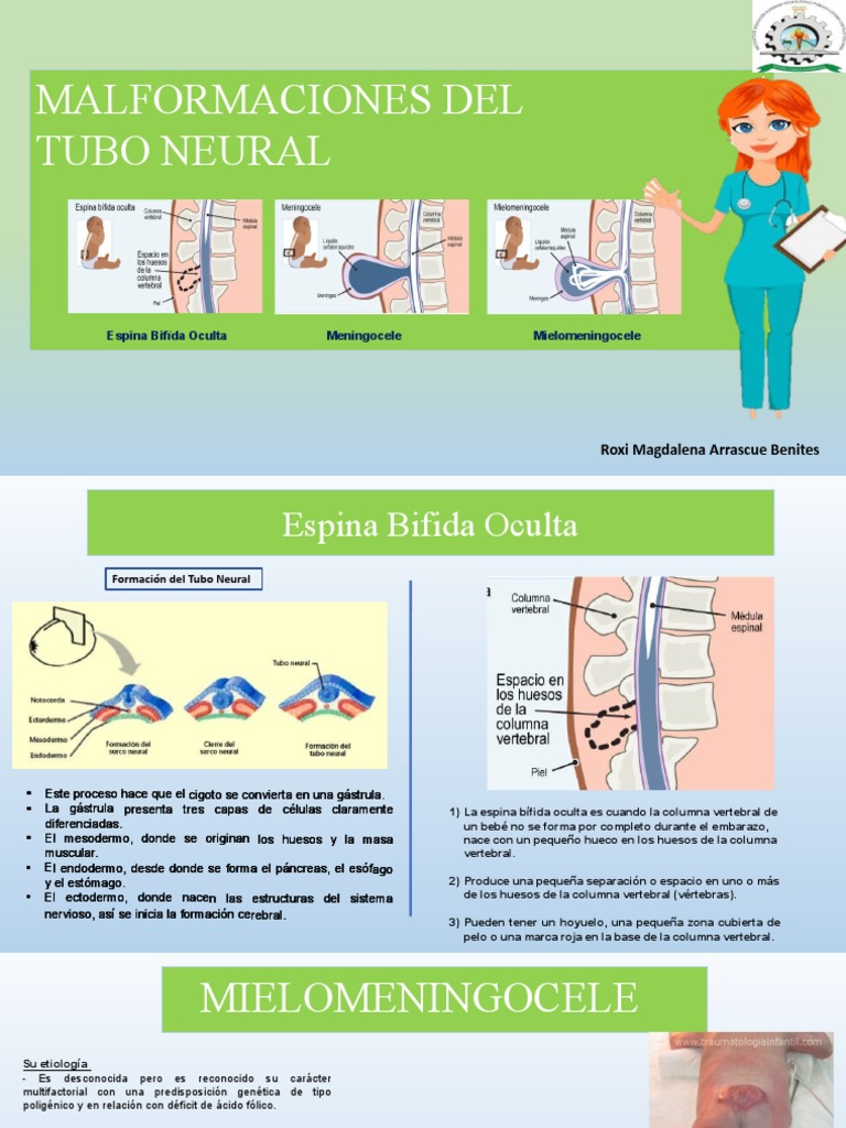 Malformaciones Del Tubo Neural | PDF | Especialidades Medicas | Órgano ...