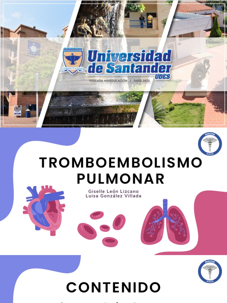 Tromboembolismo Pulmonar (TEP) | PDF | Embolia | Trombo