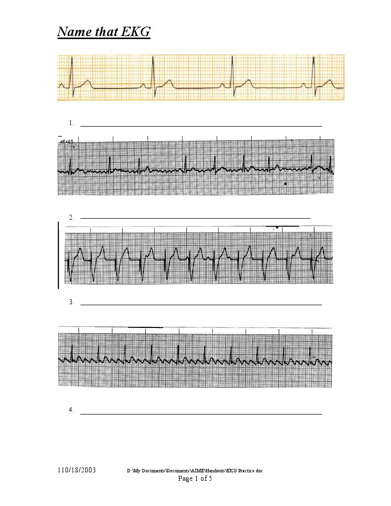 Name That EKG: D:/My Documents/Documents/AIME/Handouts/EKG Practice | PDF