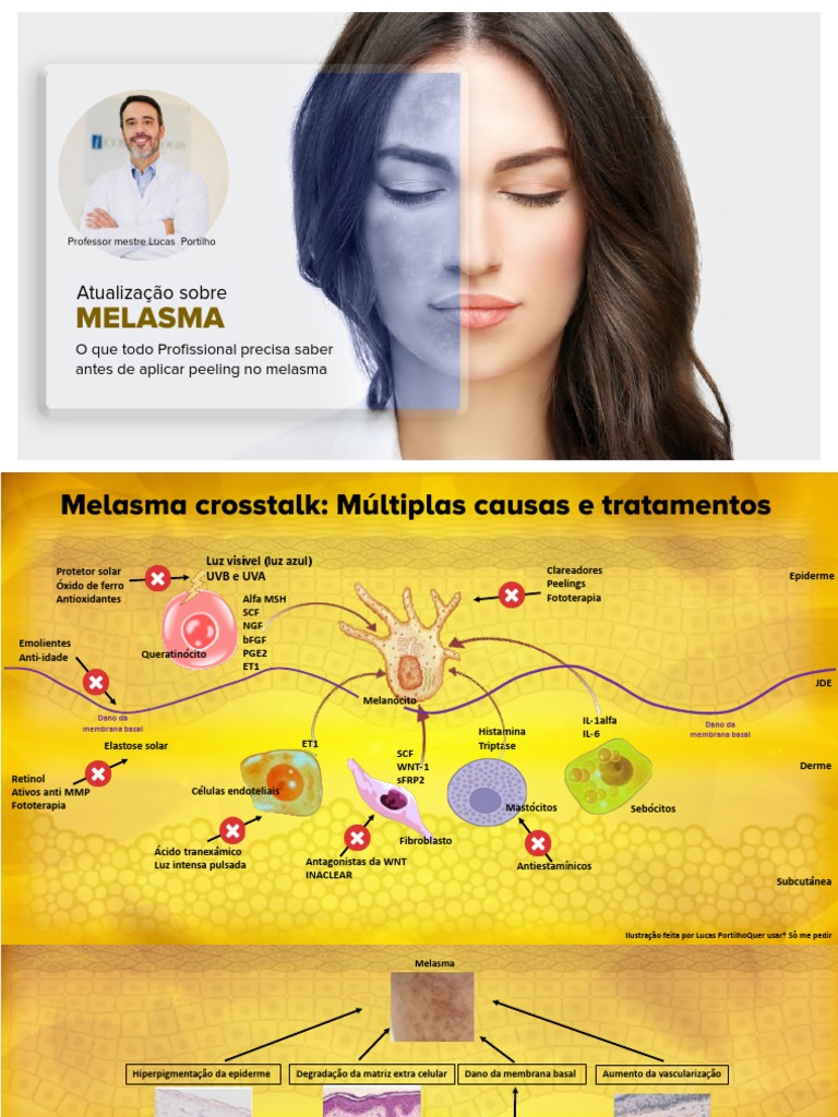 Lucas Portilho - Simpósio de Melasma | PDF | Ultravioleta | Pele