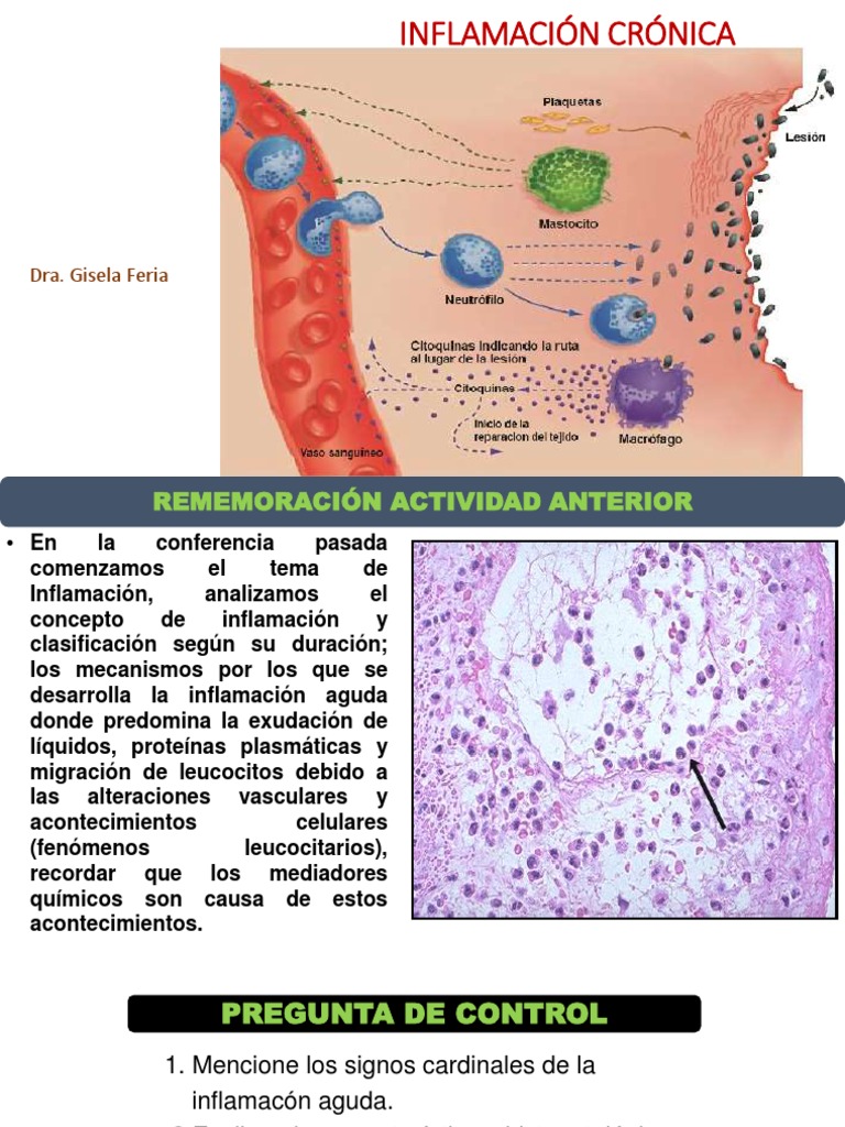 Inflamación Crónica | PDF